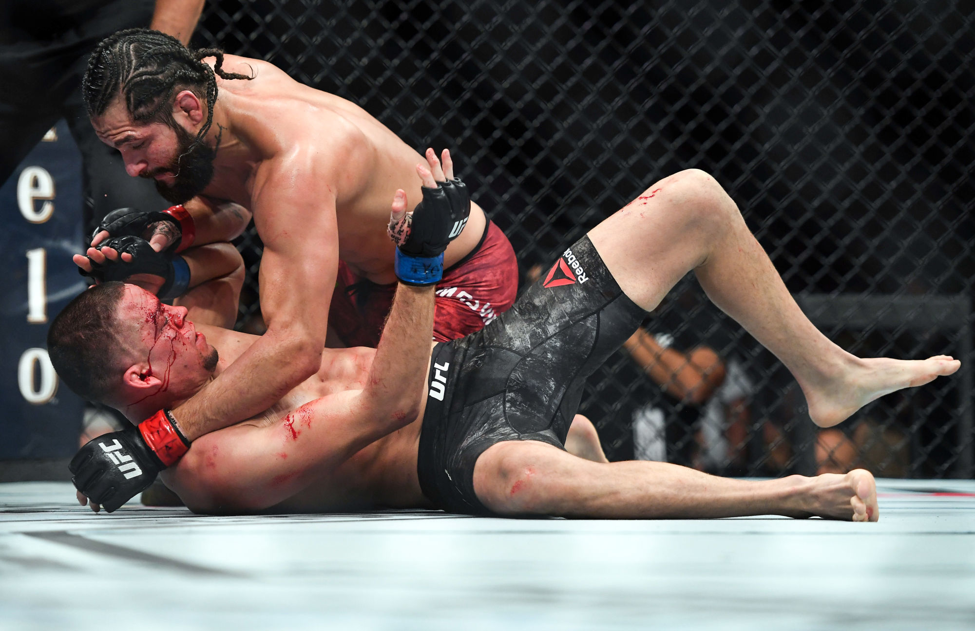 UFC : La lourde blessure de Nate Diaz contre Masvidal (PHOTOS) - Sport.fr